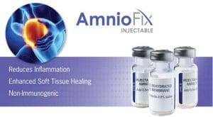 AMNIOFIX® | SLR Medical Consulting